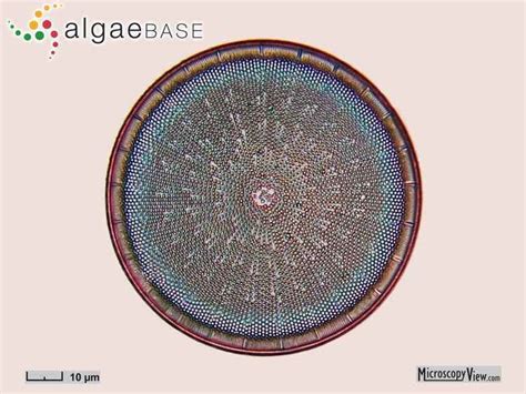 Actinocyclus Alchetron The Free Social Encyclopedia