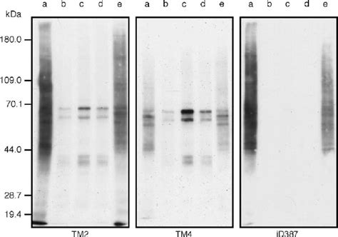 Isoasp Formation In The Sarkosyl Insoluble Tau In P301l And R406w