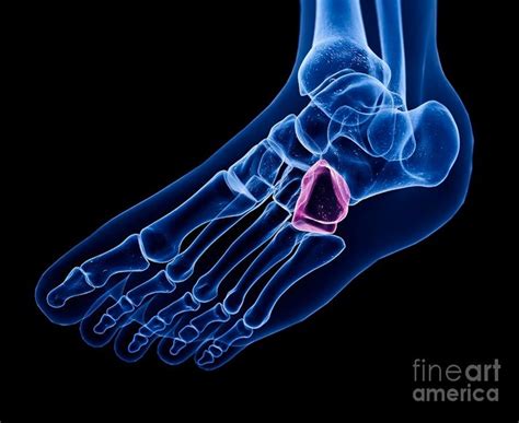 Cuboid Syndrome Hempstead Therapy Centre