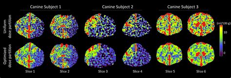 Figure 10 From Statistical Properties Of Cerebral Ct Perfusion Imaging Systems Part I Cerebral