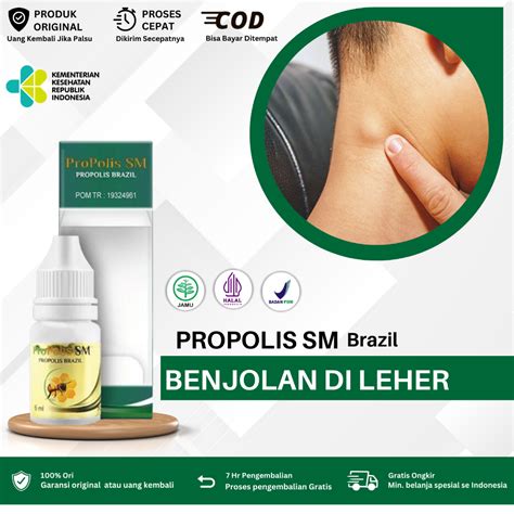 Thyroid Gland Medicine Menahun Lymph Node Medicine Lumps Medicine