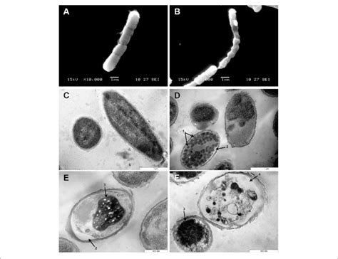 Scanning And Transmission Electron Micrographs Of Armadillidin H
