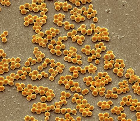 Group A Streptococcus Bacteria Sem Stock Image C057 3767 Science
