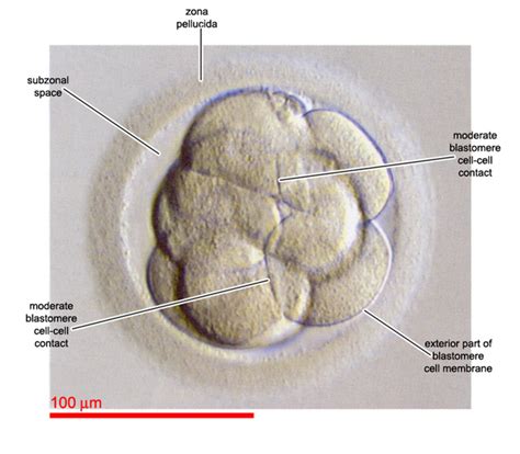 What Is A Compacting Embryo At Cora Turner Blog