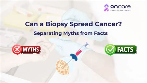 Can A Biopsy Spread Cancer Myths And Facts Of Cancer Biopsy