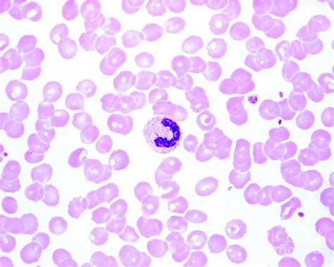 Human Blood Smear Photograph By Jose Calvo Science Photo Library