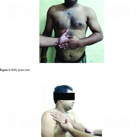 Coracoid Impingement Download Scientific Diagram