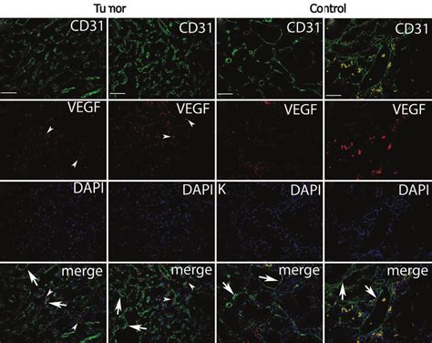 Double Immunofluorescence Staining Revealed No Coexpression Of Cd31 And