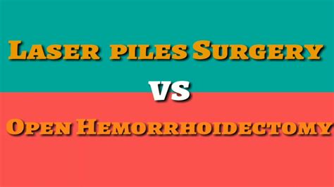 Laser Piles Hemorrhoidoplasty Surgery Vs Open Hemorrhoidectomy