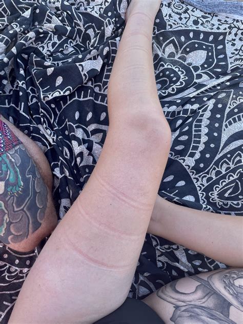Rope Marks After Shibari Sesion Are The Best Rropemarks