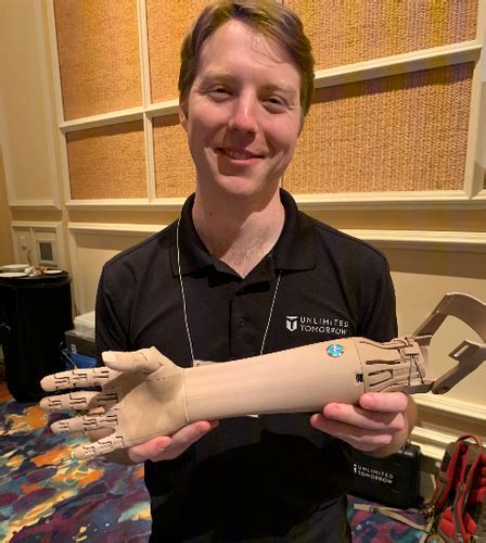 Unlimited Tomorrow Making Plans For Prosthetics Needs Globally Fierceelectronics