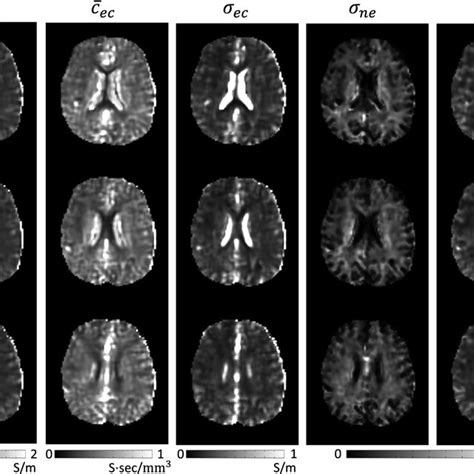 magnitude phase and segmented csf gm wm images from the third