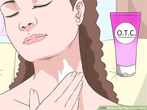 Ways To Get Rid Of Neck Acne WikiHow