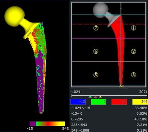 Density Mapping Using 3D Templating Software The Contact State Is