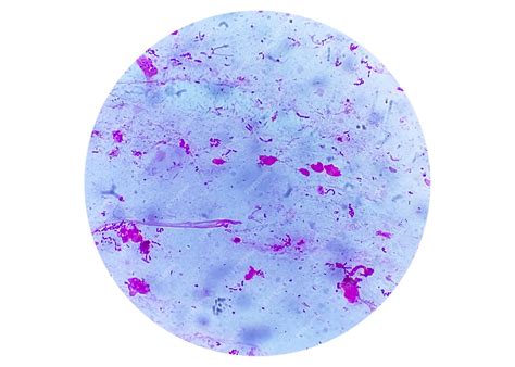 Premium Photo Gram Stain Gram Positive Cocci Or Gram Positive Diplococci Bacteria