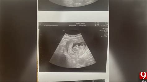 News 9s Hannah Scholl Announces Pregnancy