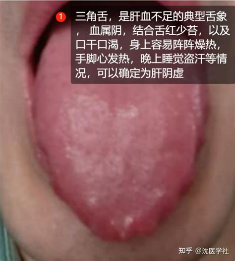 中年头晕 眼花、半夜醒？根在肝阴虚！一个中成药，让你肝好命更长 知乎