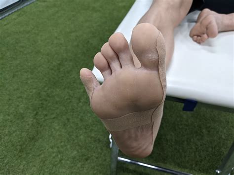 足の指の付け根の違和感・痛みに対する外反母趾のテーピング Pleady