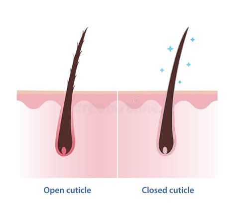 Scalp Layer Stock Illustrations 1 144 Scalp Layer Stock Illustrations