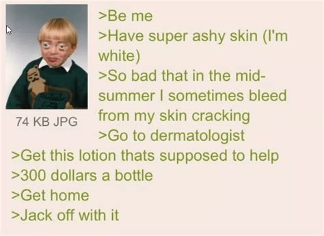 anon has sensitive skin r greentext
