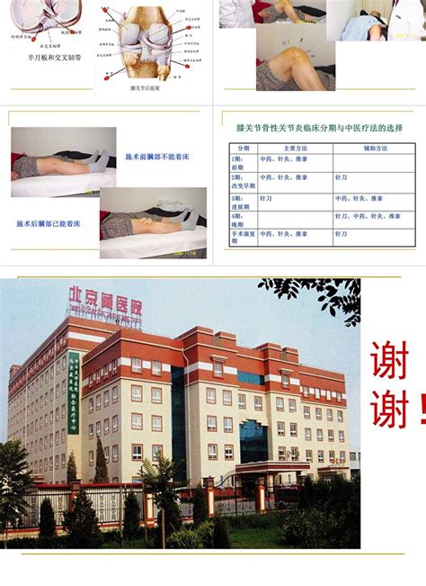 膝关节骨性关节炎的中医综合治疗ppt模板卡卡办公