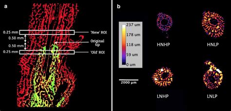 Skeletal Microstructure Of A Polystoma From Different Nutrient