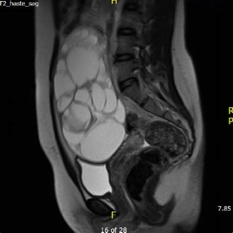Pelvic Magnetic Resonance Images Download Scientific Diagram