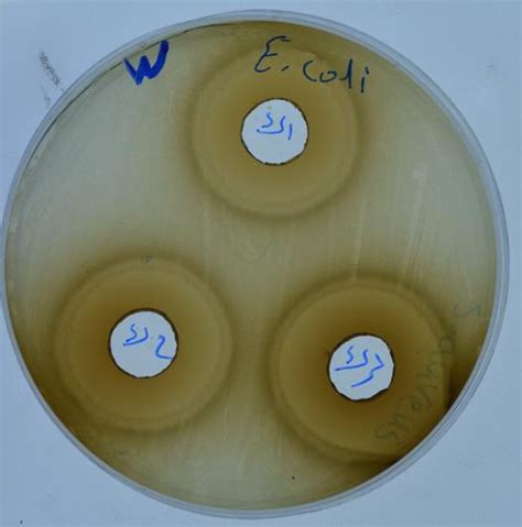 B Diameter Of Inhibition Zone Of The Alcoholic Extract Of Roselle