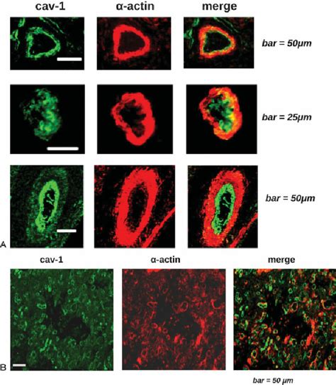 Expression Of Caveolin 1 Green And Smooth Muscle α Actin Red In