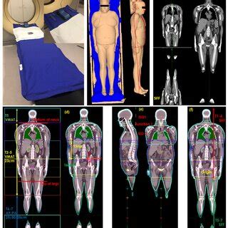 CT Simulation Volumes Of Interest And Points Of Interest A Download Scientific Diagram