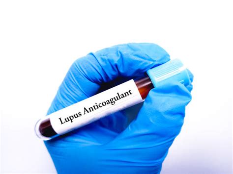 100 Antithrombin Foto Stok Potret And Gambar Bebas Royalti Istock