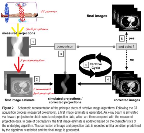 Biomedical Engineering How Is The First Image Estimate Generated In CT Scan Iterative