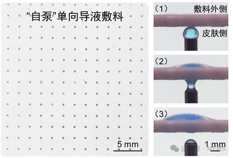 “自泵”单向导液敷料，促进伤口愈合黏性开发王树涛