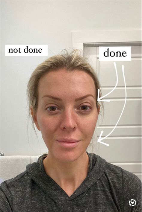 Before After Gua Sha Gua Sha Gua Sha Tools Chinese Beauty