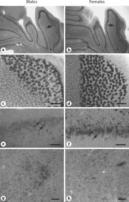 Sex Differences In The Cerebellum And Frontal Cortex Roles Of Estrogen