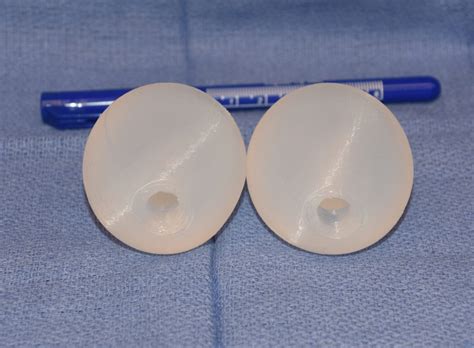 Special Design Testicuar Implants Dr Barry Eppley Indianapolis