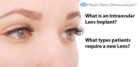 Lens In Eye Surgery At George Farrow Blog