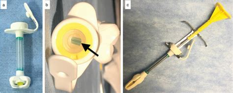 A Button Gastrostomy Tube With A Caliber Of 16 F To 24 F And Length Download Scientific