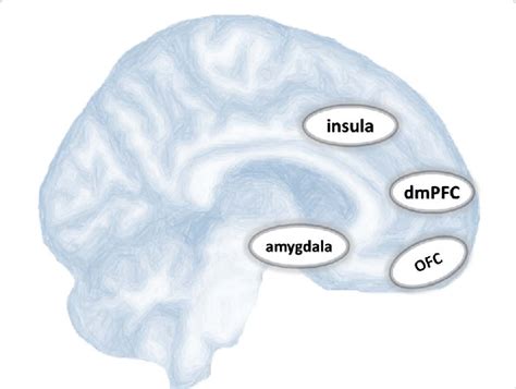 Schematic Overview Of Brain Regions Commonly Affected In Conduct Download Scientific Diagram