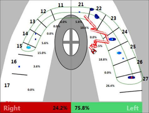 The Occlusal Force Distribution At Donte Johnson Blog