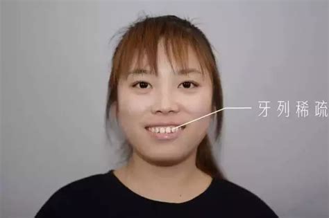 牙不整齐图片牙齿不整齐图片第10页大山谷图库
