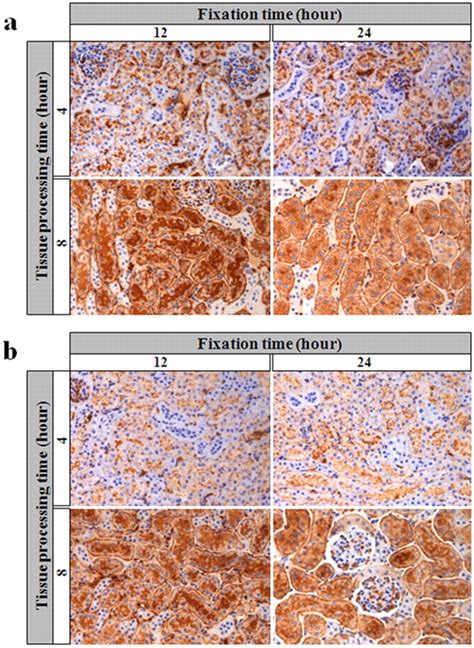 Factors Influencing The Degradation Of Archival Formalin Fixed Paraffin Embedded Tissue Sections