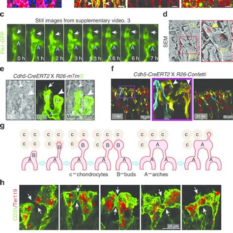 Schematic Representation Of Key Findings Postnatal Angiogenesis In