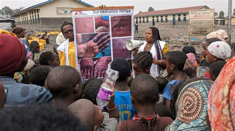 Who Declares Mpox Outbreaks In Africa A Global Health Emergency As A New Form Of The Virus