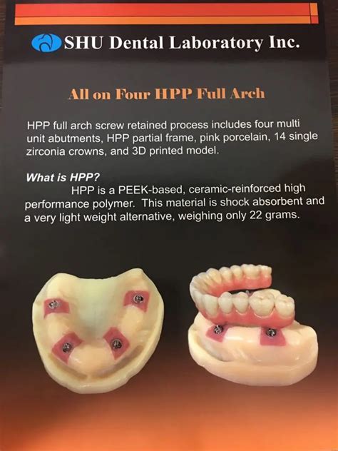 Professional Dental Insights Shu Dental Laboratory Inc