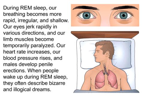 Sleep Disorders