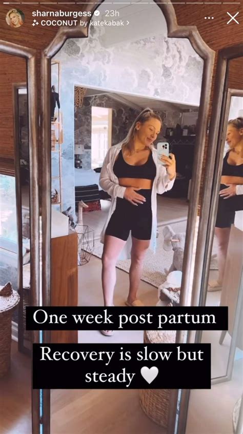 Sharna Burgess Opens Up About Having A C Section After Birth Of Son
