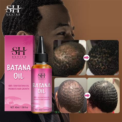 100 Pure Natural Batana Hair Growth Oil Hair Growth Oil And Hair Oil