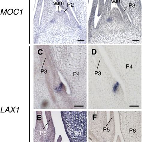 Expression Patterns Of Moc1 And Lax1 During Axillary Bud Formation A