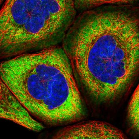 Rabbit Polyclonal Anti Hars2 Antibody Buy For Research Highly